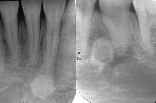 TRATAMIENTOS DENTALES