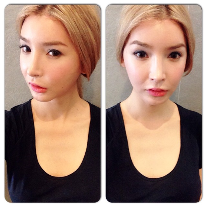 ID Hospital Korea: Jenna Talackova is back at ID Hospital!!