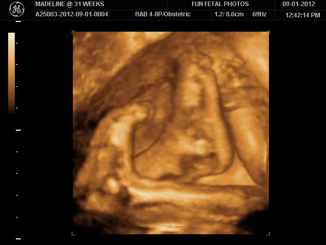 And Then There Were Three: 31 Weeks