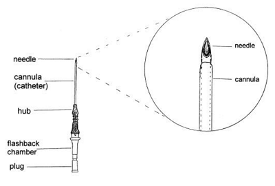 Stacy's Blog on IV insertion