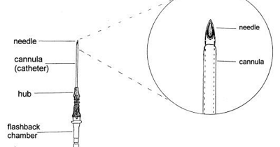 Stacy's Blog on IV insertion