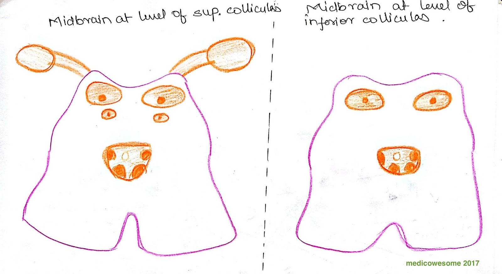 Medicowesome: How to draw midbrain sections and lesions (Fun mnemonic ...