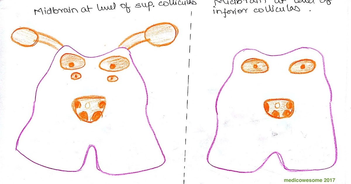 Medicowesome: How to draw midbrain sections and lesions (Fun mnemonic ...