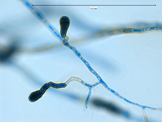 Fun With Microbiology (What's Buggin' You?): Pithomyces species