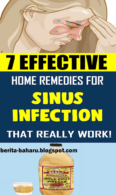 9 Effective Home Remedies For Sinus Infection