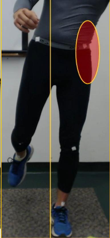 Move to Improve: Does Excessive Lateral Trunk Lean Lead to Injury in ...