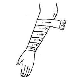 VENDAJES.........: PROCEDIMIENTOS DE VENDAJES