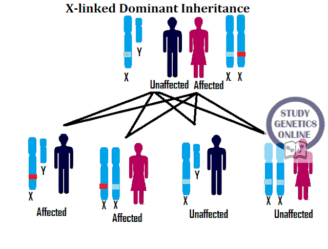 Study Genetics Online: X-linked dominant inheritance