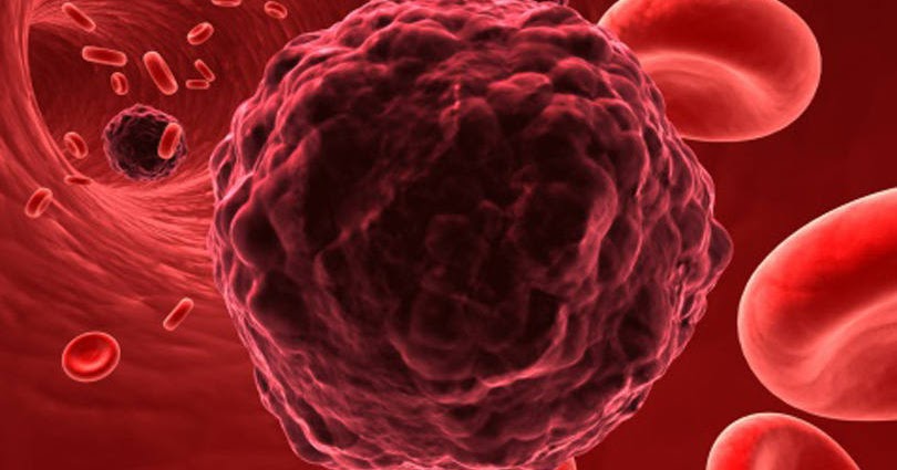 DICAS DE RADIOLOGIA - Tudo Sobre Radiologia: CÉLULAS DO CÂNCER SÃO ...