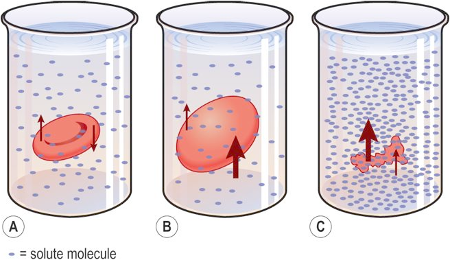 Soluciones Hipertonicas