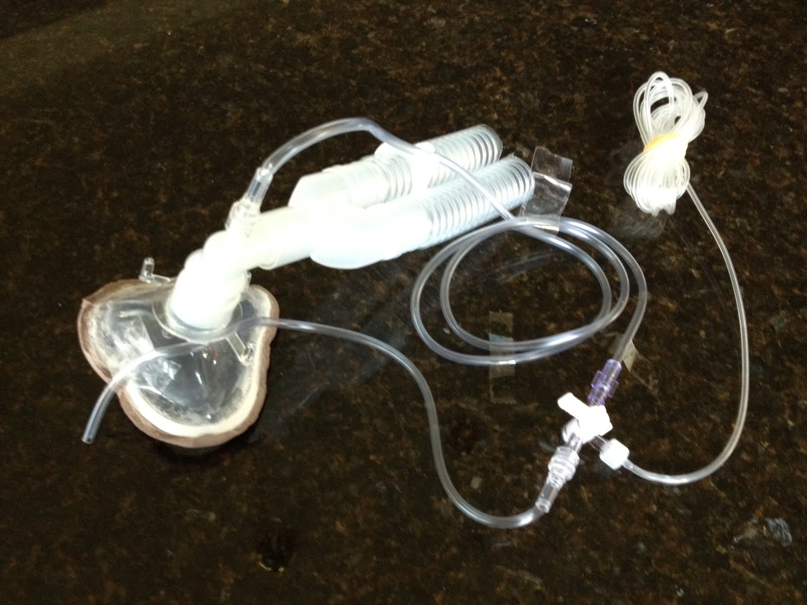Glidescope Jack: Nasal Tse PAP -the next big thing in Anesthesiology