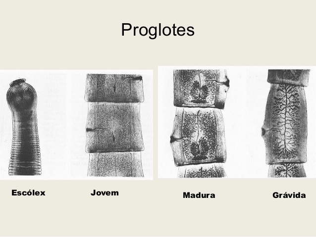 Tênias e a Teníase - Análises Clínicas.com