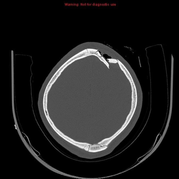 LES MALHEURS DE TINTIN