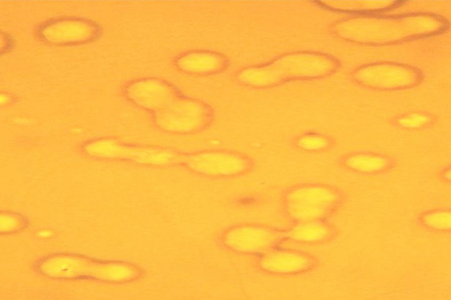 apa itu 'fusi protoplas' ?? - it’s a long long journey...