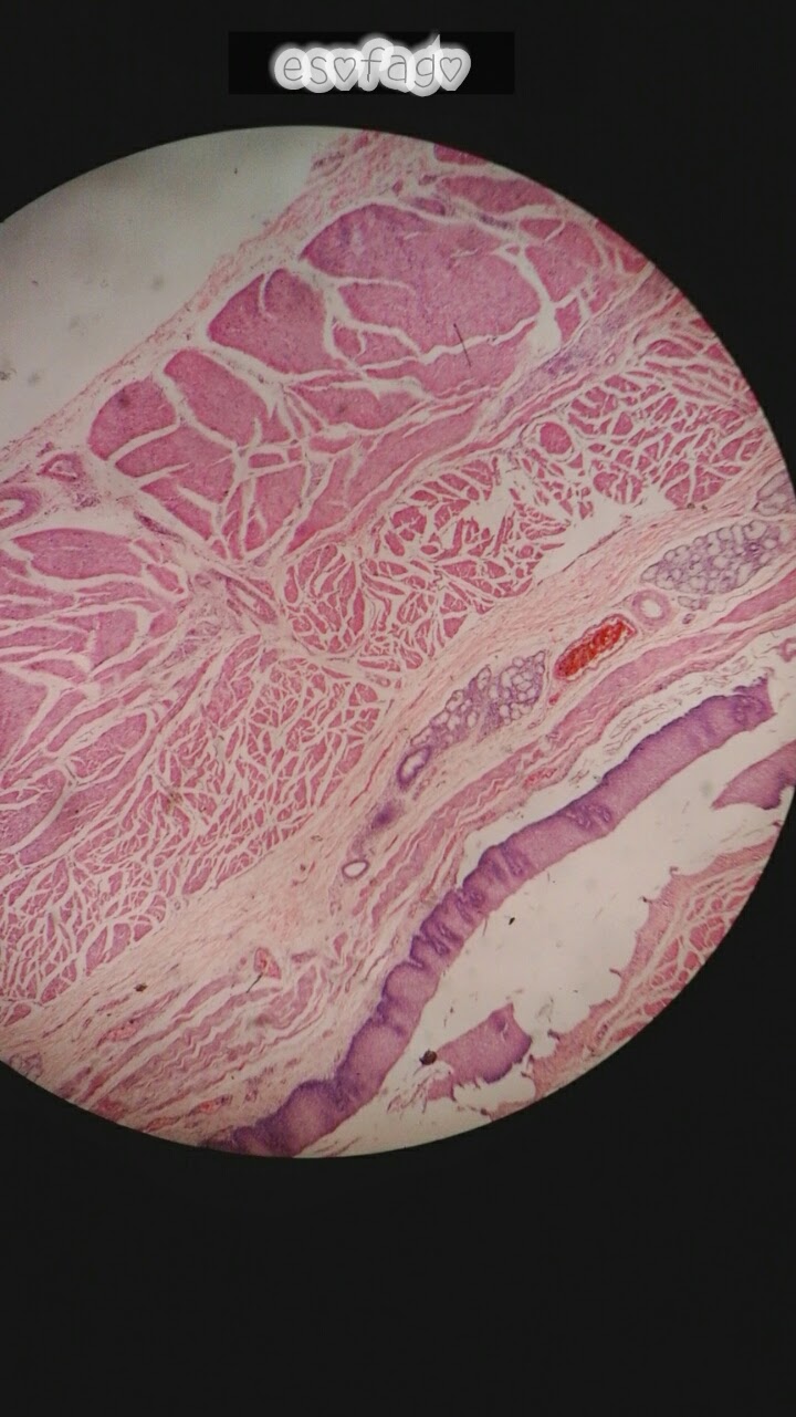 Placas de histología : Esófago