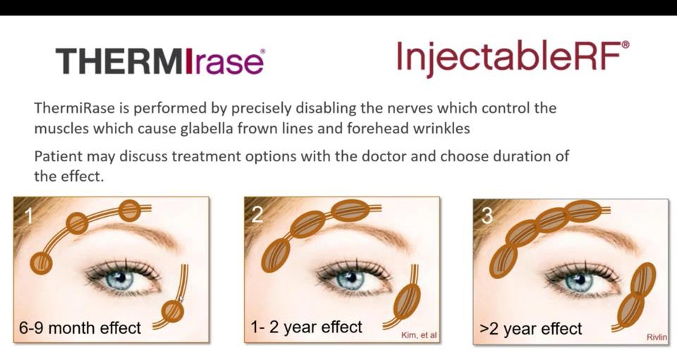 ThermiRF - Non Surgical Skin Face Treatment in Delhi, India