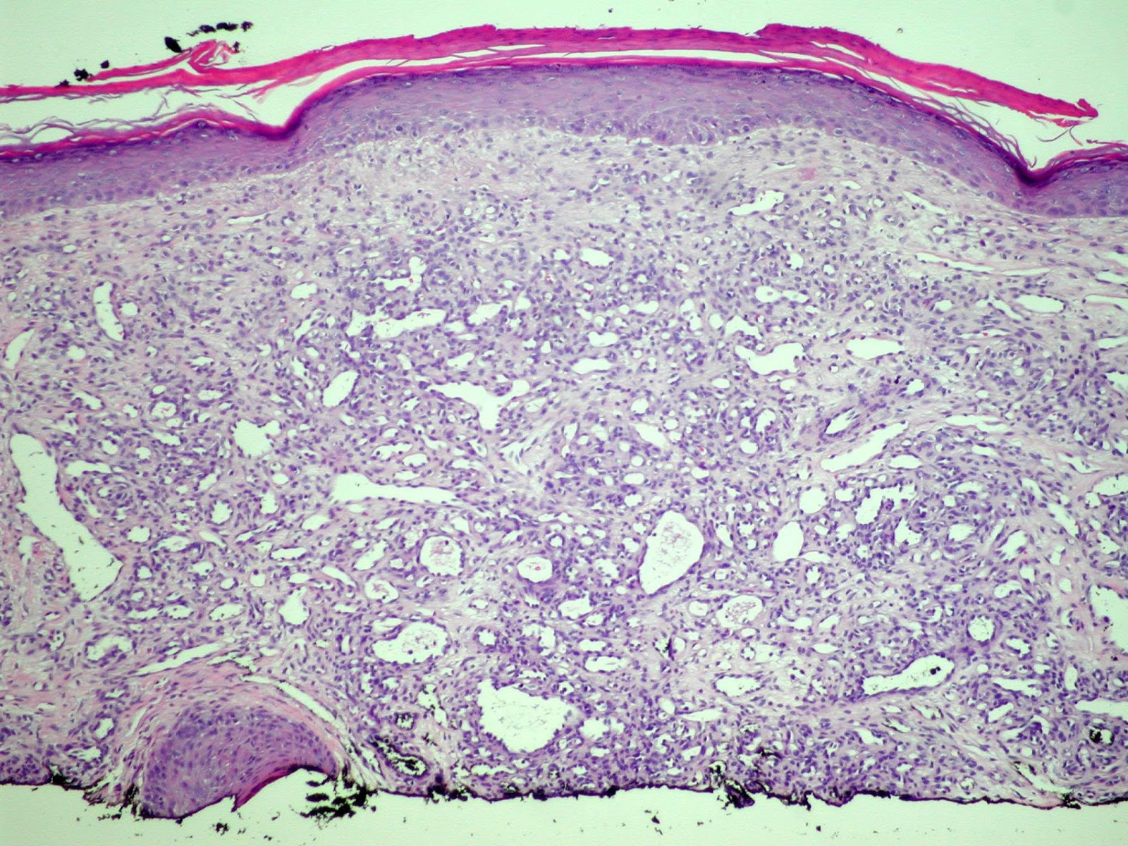 Histología - Fisioterapia IIIB: Piel