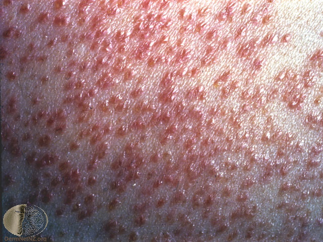 EL RINCÓN DE LA MEDICINA INTERNA. juanpedromacaluso@yahoo.com.ar ...