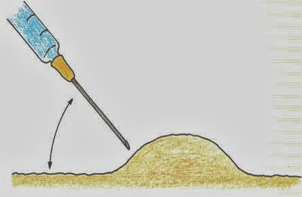 Enfermería Básica UCV : ADMINISTRACIÓN DE MEDICAMENTOS VÍA PARENTERAL