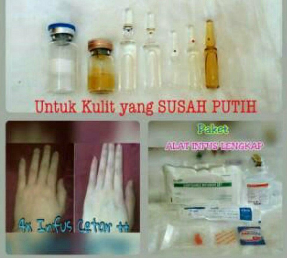 Kiki Koi Suntik Putih: Infus Super White