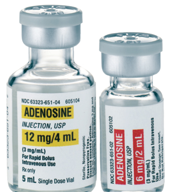 Float Nurse: ACLS review: Wide Complex Tachycardia (WCT) Part 5