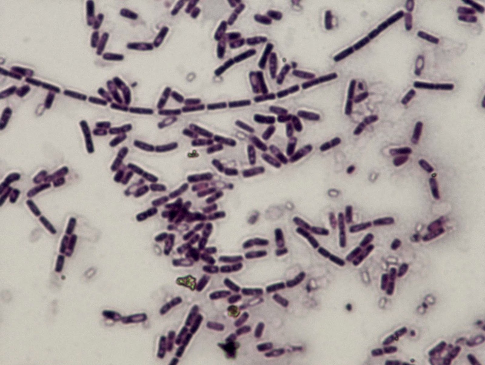 BACILLUS CEREUS