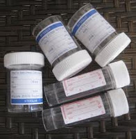 fundamental of nursing: PENGUMPULAN SPESIMEN