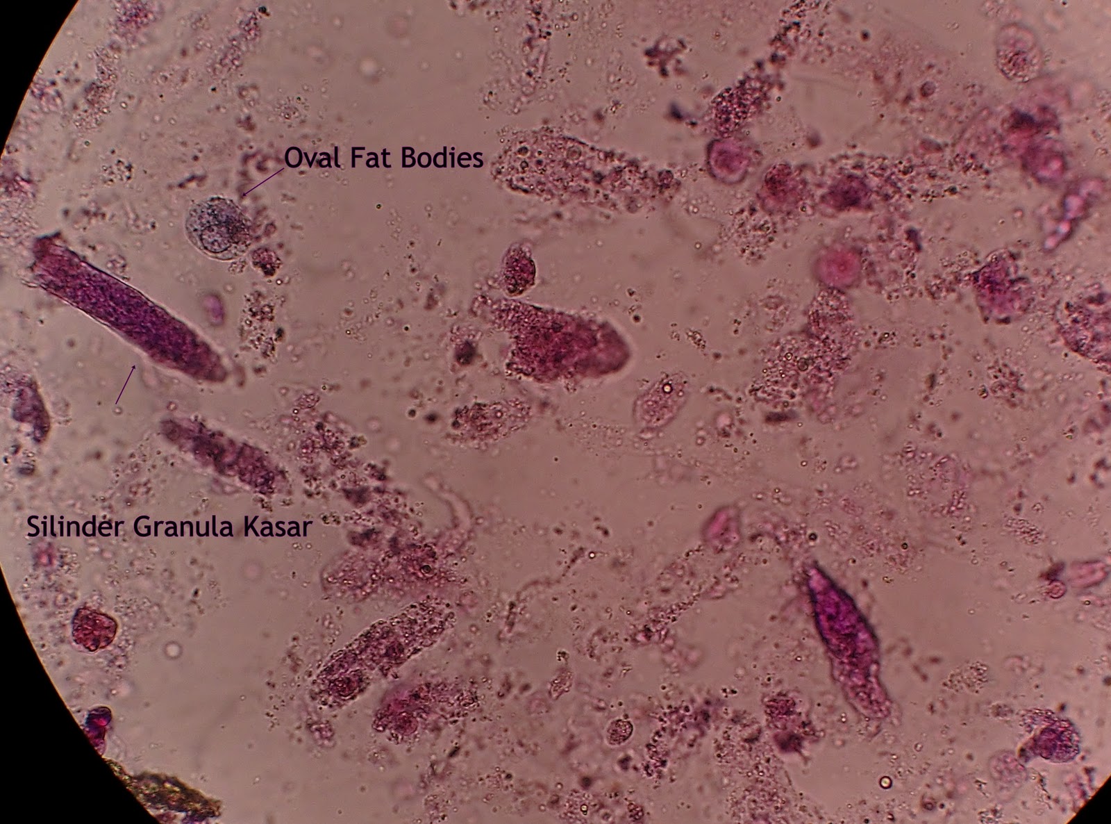 Sedimen Urine Metode Pewarnaan (Stainning) | Analis Kesehatan
