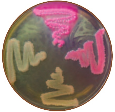 [Microbiology] MacConkey Agar | Free Medical Atlas