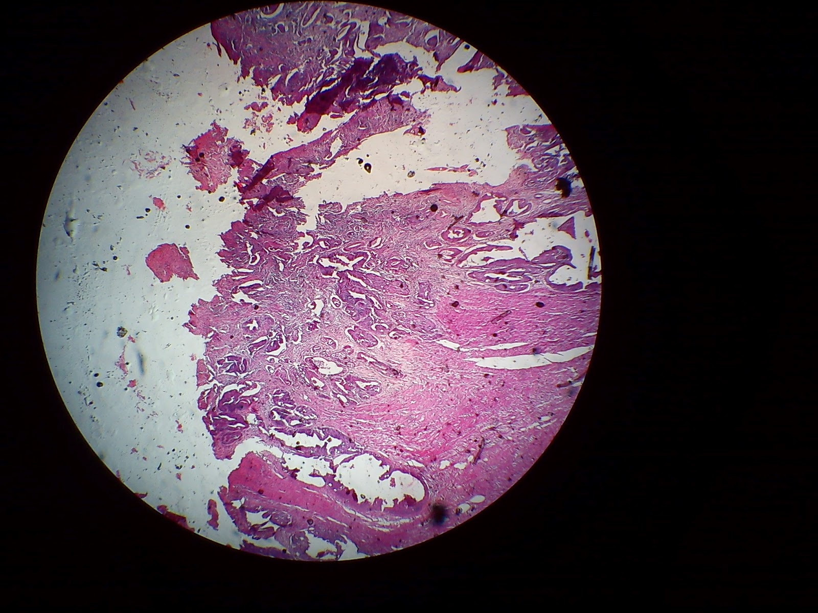 Ca - CaDo (Catatan Calon Dokter): Blok 13 : Praktikum Patologi Anatomi ...