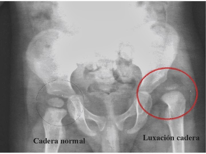 Articulos de interes para Empresas y Pymes: Rehabilitación de una ...