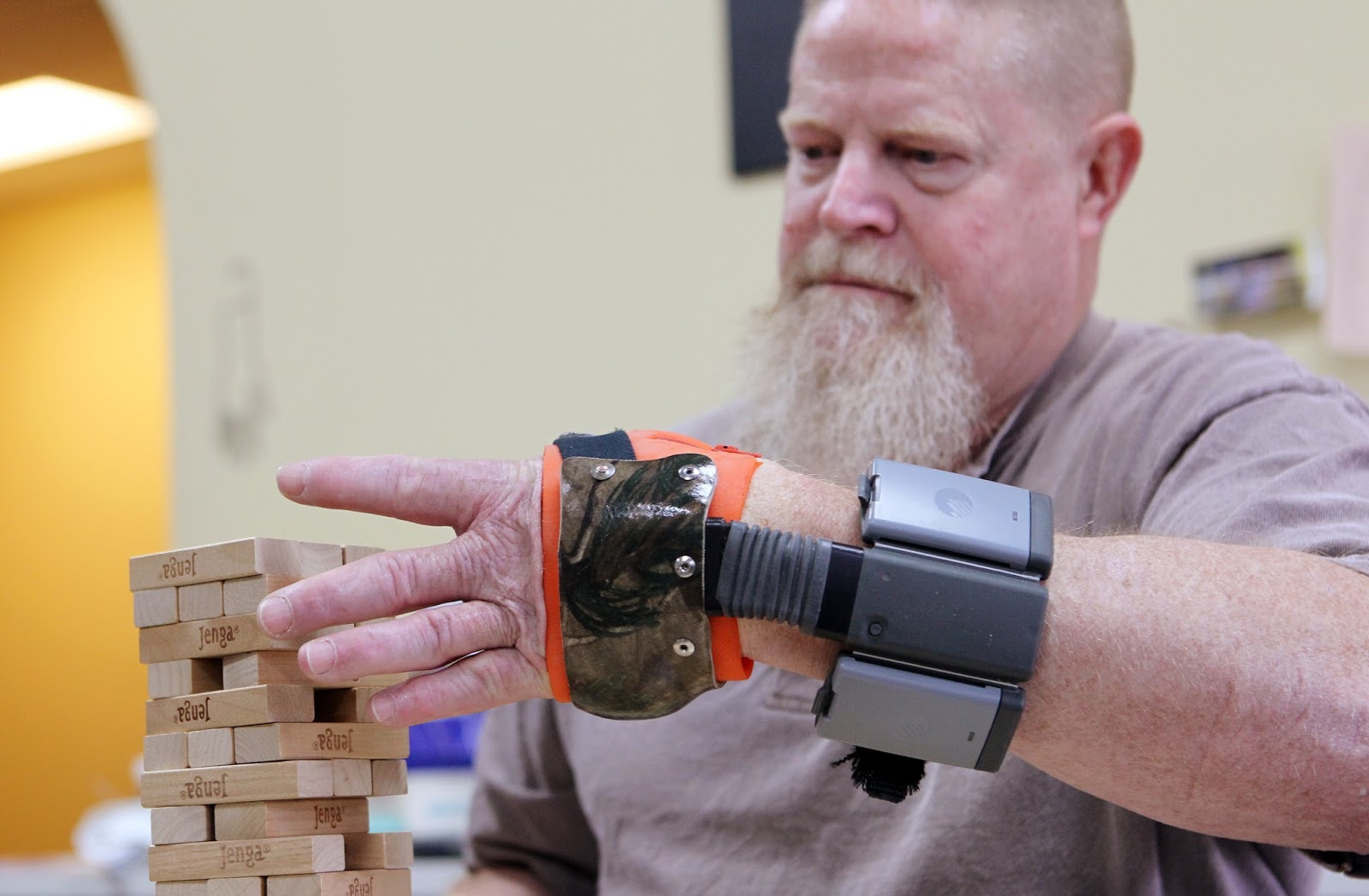 Mark Kodiak Ukena: Adam Pringle and his Bionic Thumb at Dynamic Hand ...