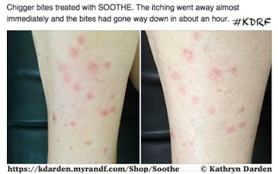 Skin, Health & Beauty: ASK KATHRYN: What Works on Chigger Bites?