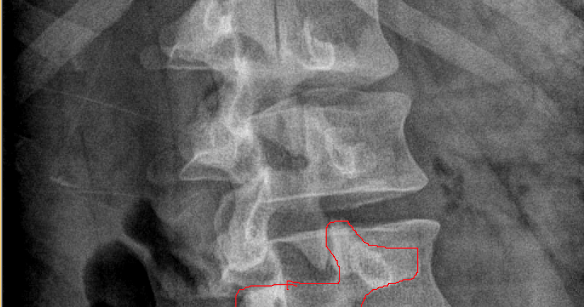 Scottish Terrier Sign- Xray - Sumer's Radiology Blog