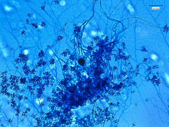 Fun With Microbiology (What's Buggin' You?): Trichoderma species