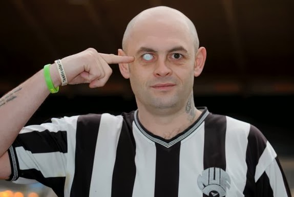Blind Newcastle fan gets club crest etched onto his glass eye | inside ...