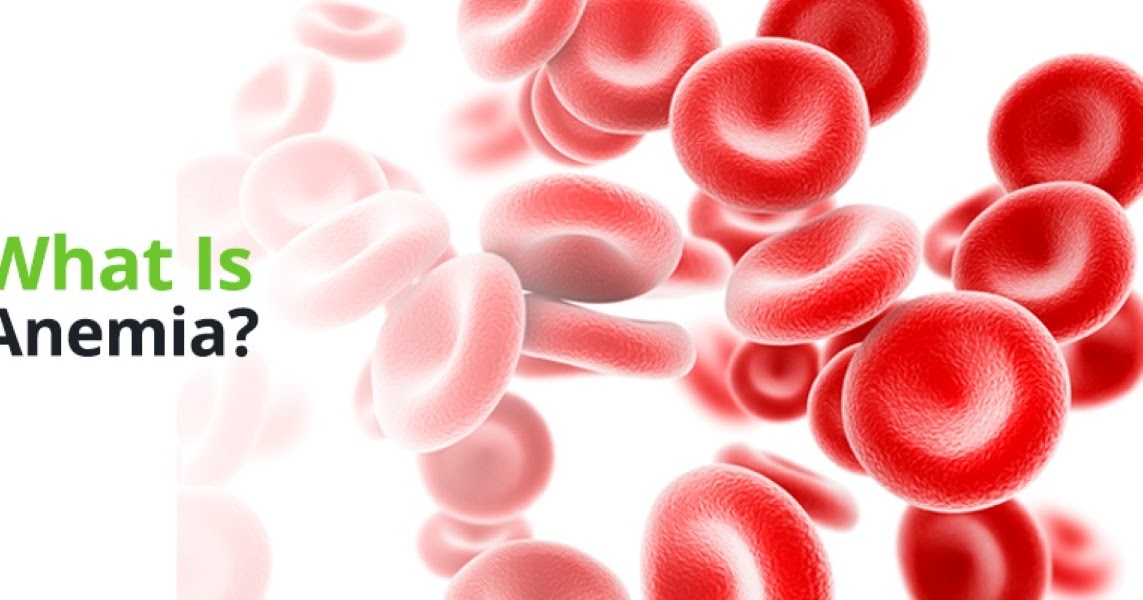 3 PUNCA UTAMA ANEMIA HARUS DIKETAHUI UNTUK KEKAL SIHAT - CUTE AND BEAUTY