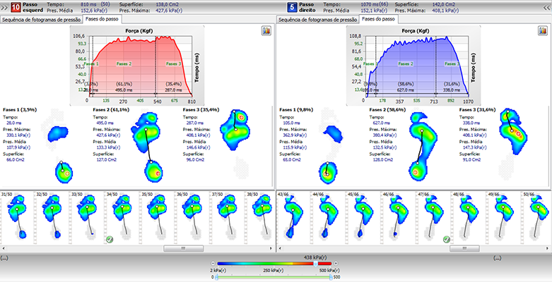 Clínica e Cirurgia do Pé e Tornozelo: Baropodometria - Teste da Pisada