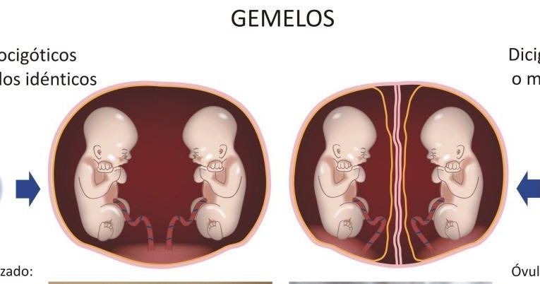 ¿Que es un embarazo multiple?