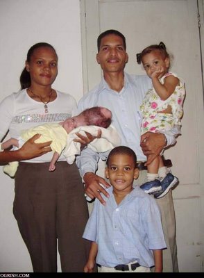 Baby born with two Head