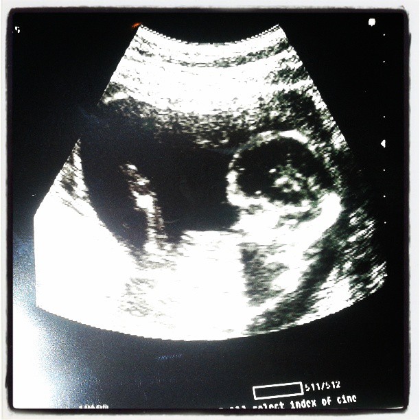 KAK NITA IN THE HOUSE: SCAN BABY MINGGU KE 16