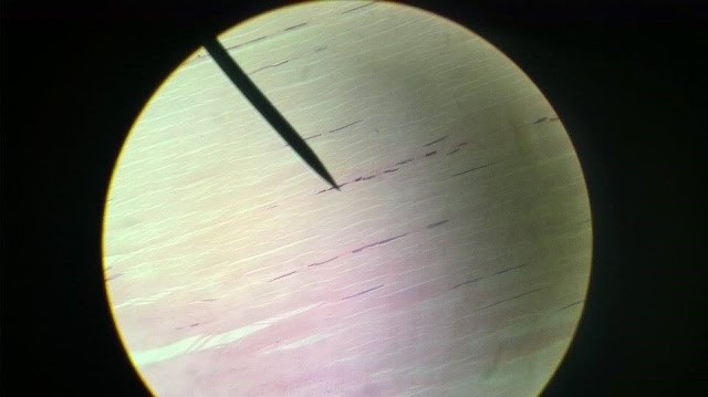 Histología: Tendón