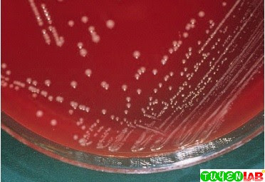 [Microbiology] Atlas of Aerobic Gram-Positive Bacilli | Free Medical Atlas