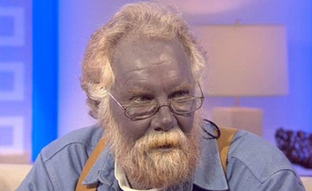 TOP 10:ENFERMEDADES MAS RARAS Y ATERRADORAS | Lo mejor de lo mejor