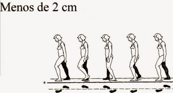 Mas Allá de la Terapia Manual: ALTERACIONES DE LA MARCHA