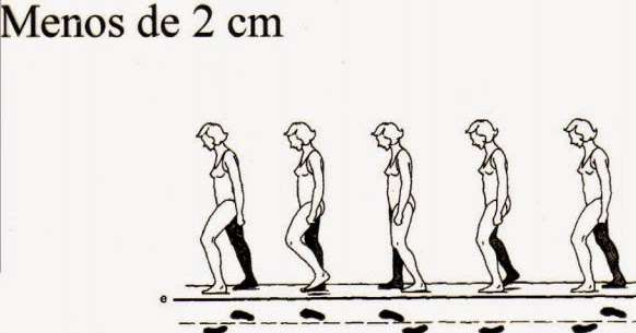 Mas Allá de la Terapia Manual: ALTERACIONES DE LA MARCHA