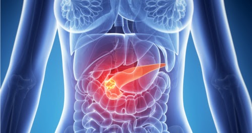 Paciente Grave: Pancreatite aguda. Estratégia nutricional: quando e como?