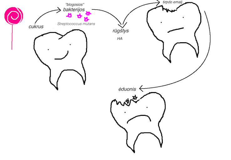 kaip išsaugoti sveikus dantis: Kas yra tas dantų ėduonis?