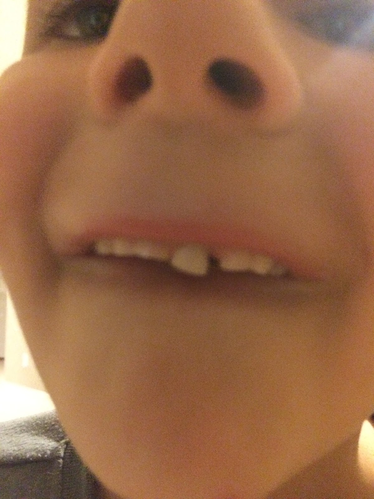 a DAY in the life: Wiggly tooth...Stubborn tooth...