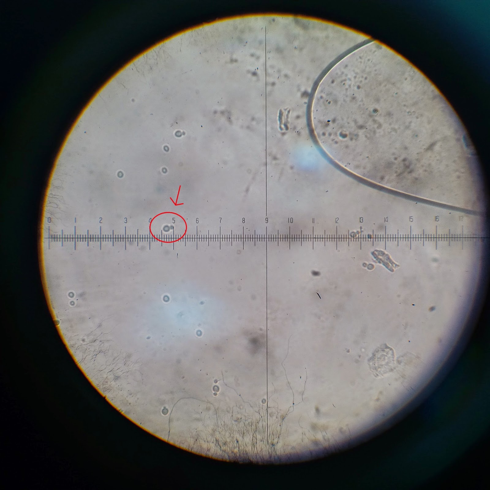 Lab IBG102: Lab 2: Measurement and Counting of Cells Using Microscope